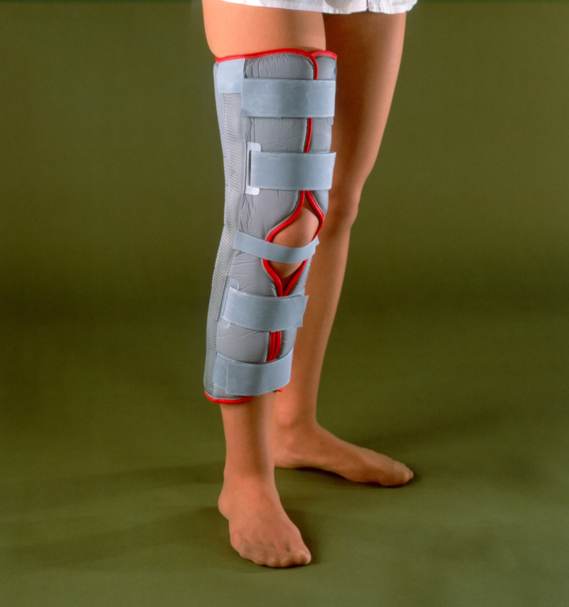 broken leg in cast – Fantex Industria – Produttore francese dal 1865 di ...